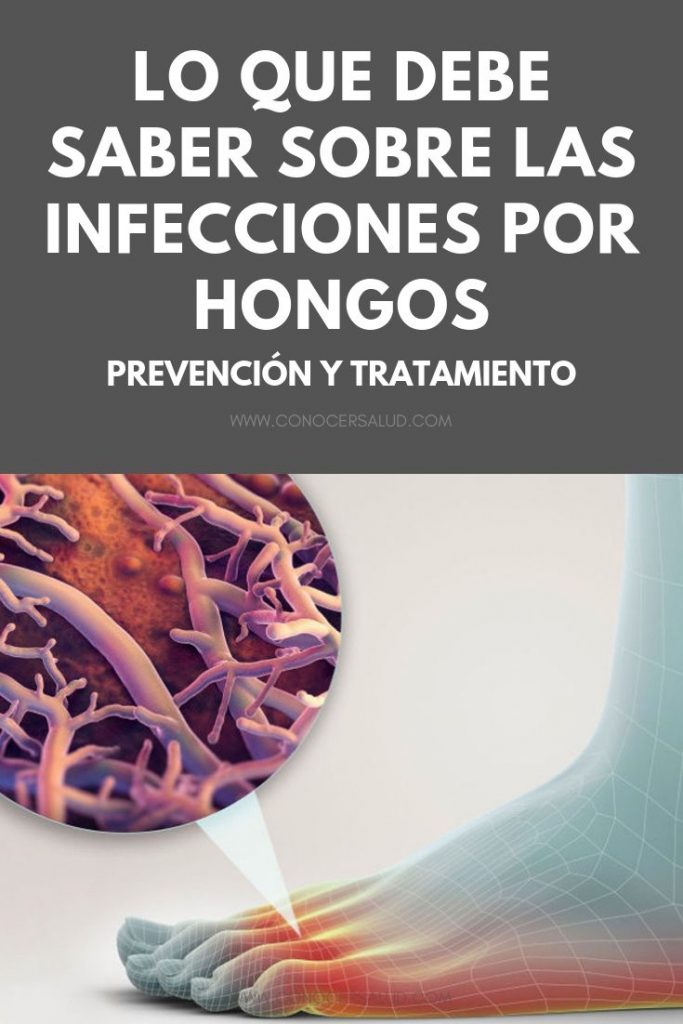 Lo que debe saber sobre las infecciones por hongos - Prevención y ...
