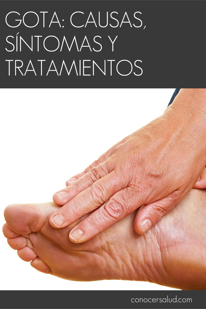 Gota: causas, síntomas y tratamientos - Conocer Salud