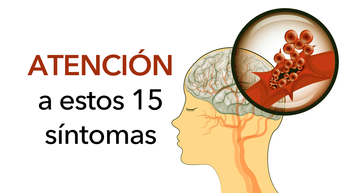 Prevenga un derrame cerebral: 15 síntomas de apoplejía que nunca hay ...